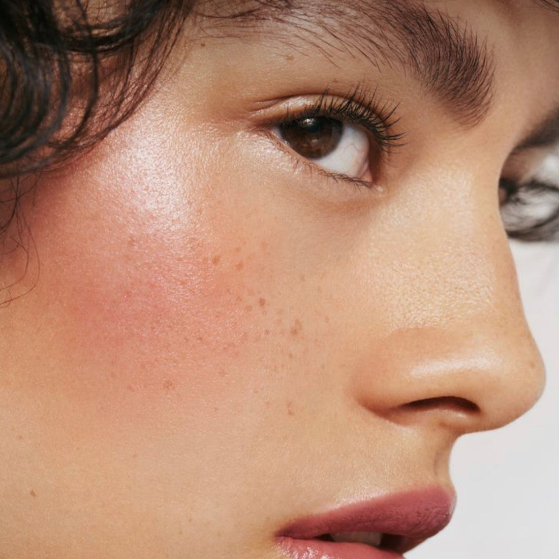Millicent Rose | No1 Skin Clinic London – Millicent Rose Skin