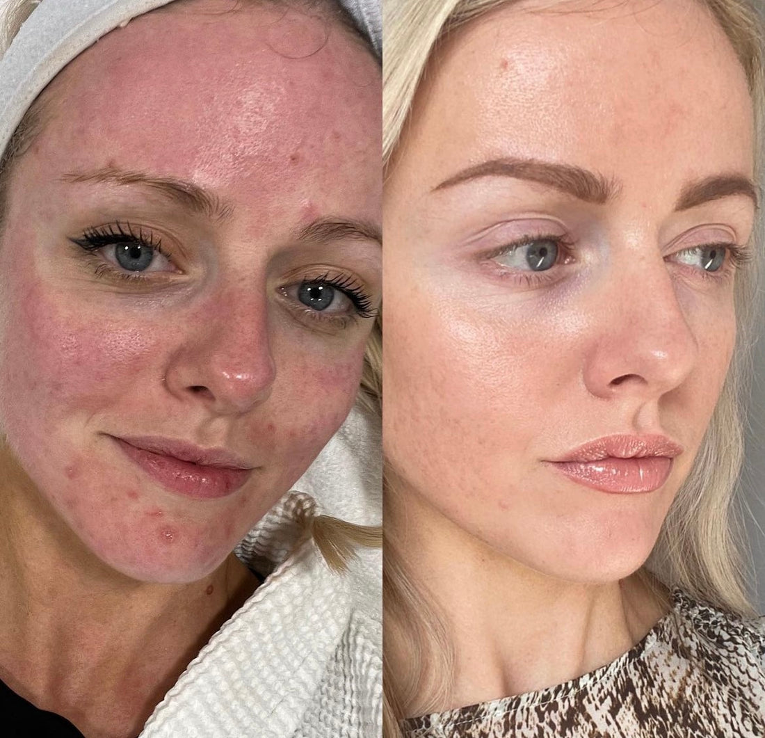 Millicent Rose | No1 Skin Clinic London – Millicent Rose Skin