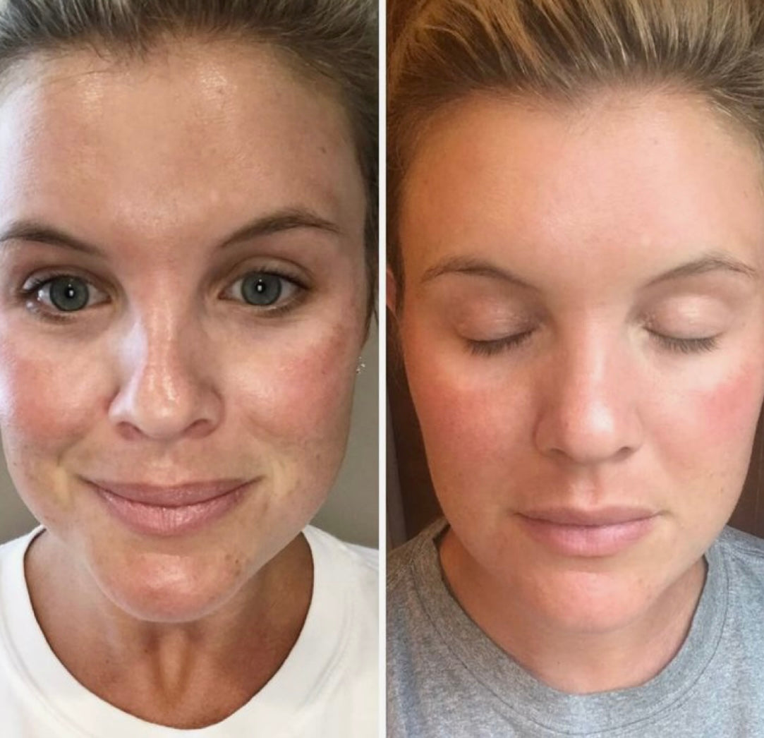 Millicent Rose | No1 Skin Clinic London – Millicent Rose Skin